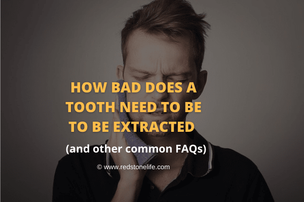 Tooth Extraction Quotes